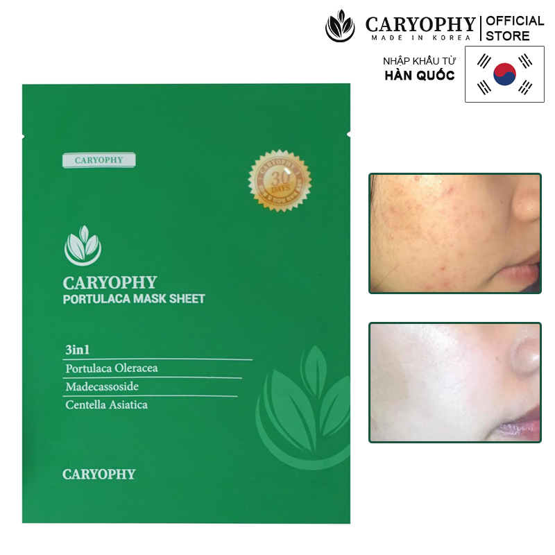 Mặt Nạ Miếng Dành Cho Da Dầu Mụn Caryophy Portulaca Mask Sheet – THẾ ...