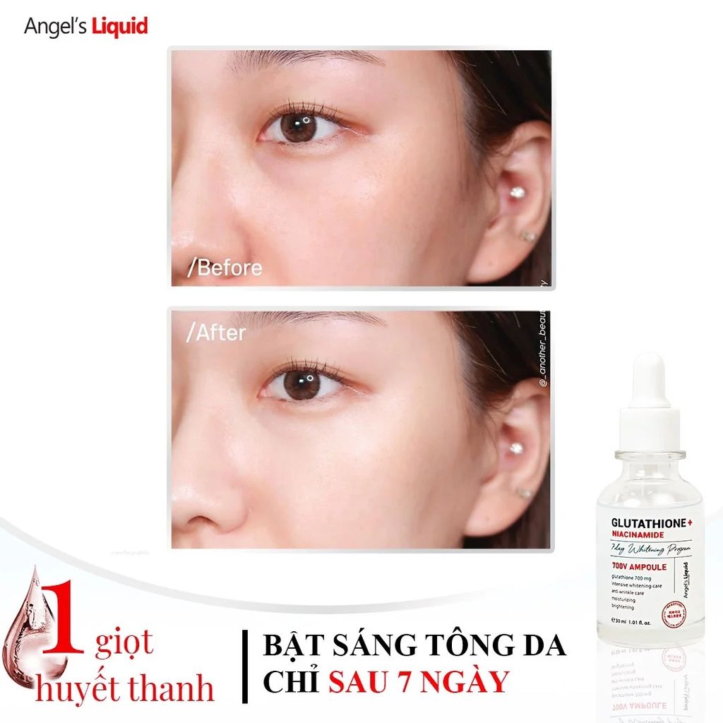 Serum Angels Liquid Glutathione + Niacinamide 700 V-Ampoule – THẾ GIỚI ...