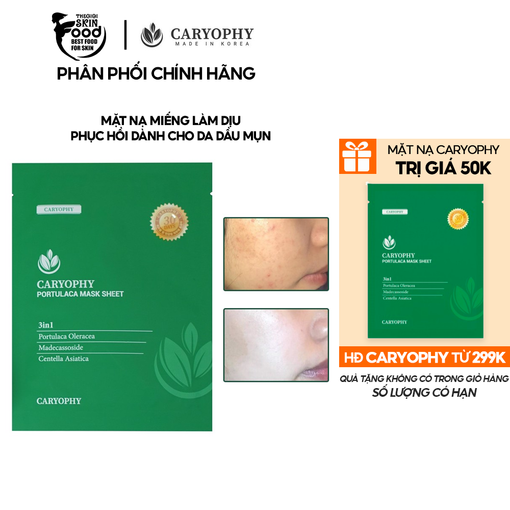 Mặt Nạ Miếng Dành Cho Da Dầu Mụn Caryophy Portulaca Mask Sheet – THẾ ...