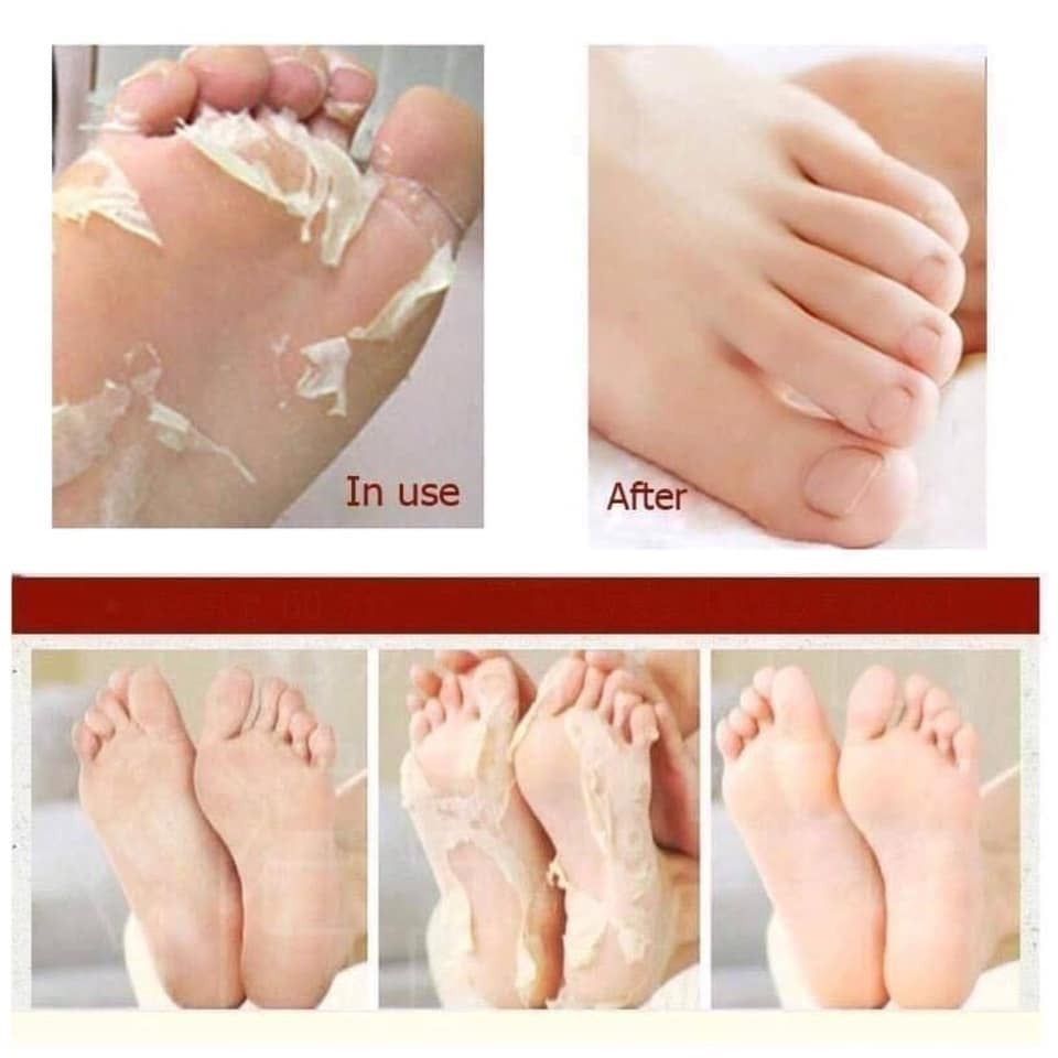 Túi ủ chân tẩy tế bào da chết Foot Care Pack Lavender – Shopnhatban247.com - Hàng Nhật nội địa