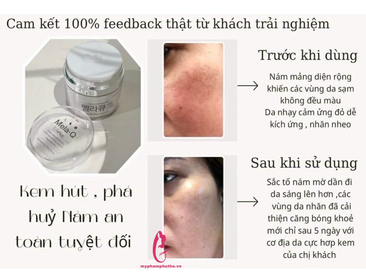 Kem trị nám Dr.MH Mela Q Plus Hàn Quốc – myphamphutho.vn