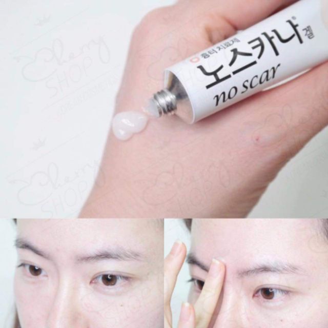 Kem Trị Sẹo Dong-A Pharm Noscarna Gel (20g)