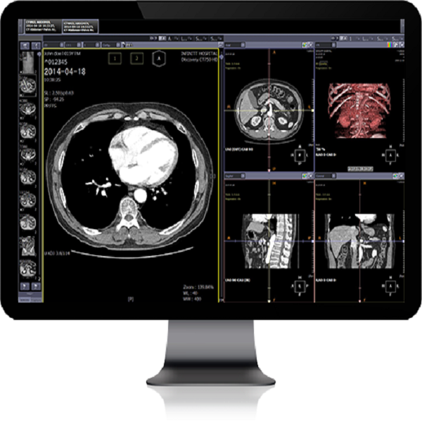 Infinitt PACS – VIKOMED