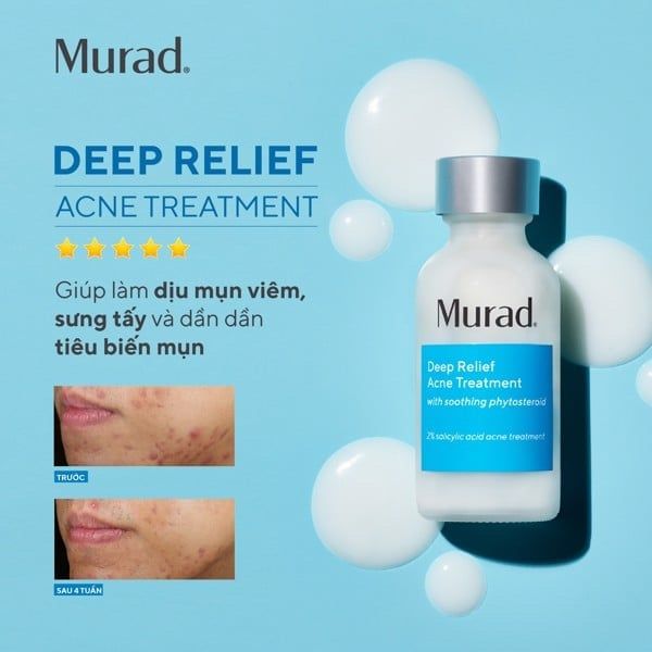 Chấm Mụn Murad Acne Control Deep Relief Acne Treatment 30ml – Mỹ Phẩm ...