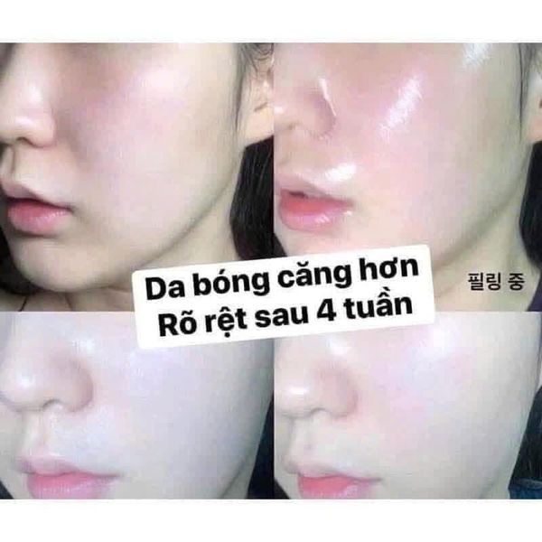 Peel CNP Rx Skin Rejuvenating Intensive 2ml Dưỡng Trắng Căng Bóng Mờ ThâmPeel CNP Rx Skin ...