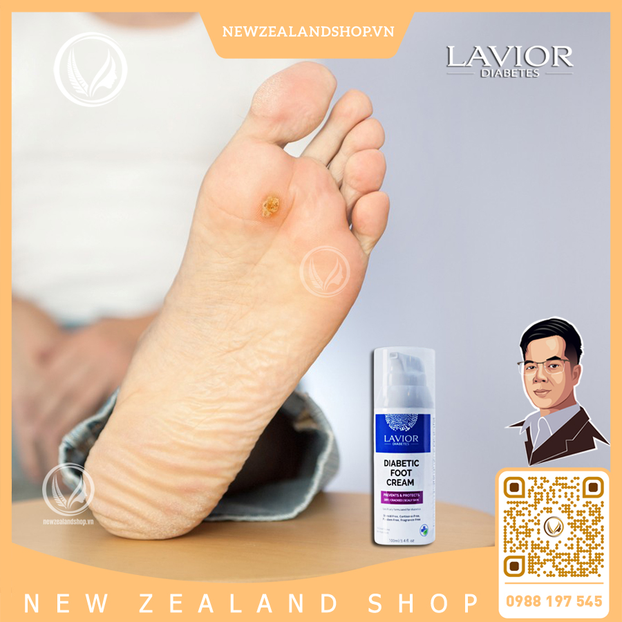 Kem chống loét tì đè, lở loét chân do tiểu đường Lavior Diabetic Foot