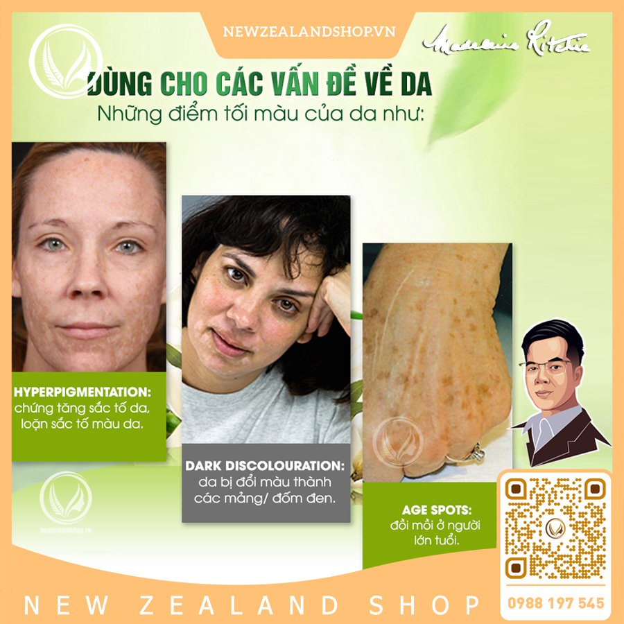 Kem trị nám, tàn nhang Madeleine Ritchie Dark Spot Remover