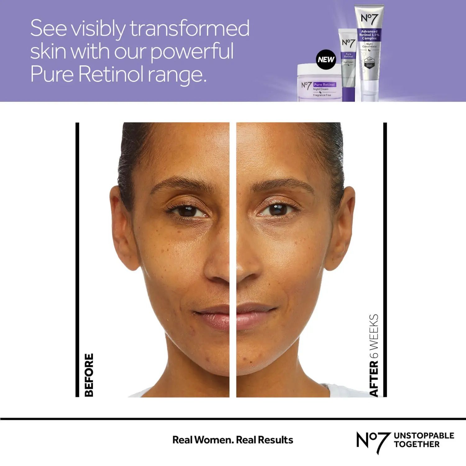 Pure Retinol Night Cream – Din House