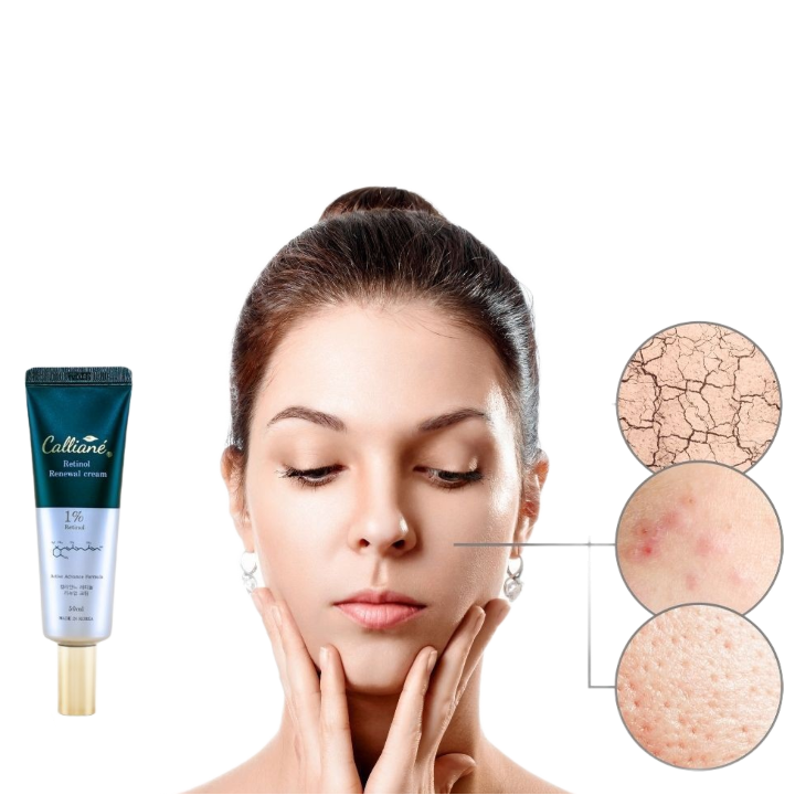 Kem Dưỡng Tái Tạo Chống Lão Hoá Da Retinol 1% Calliané – NT Mart