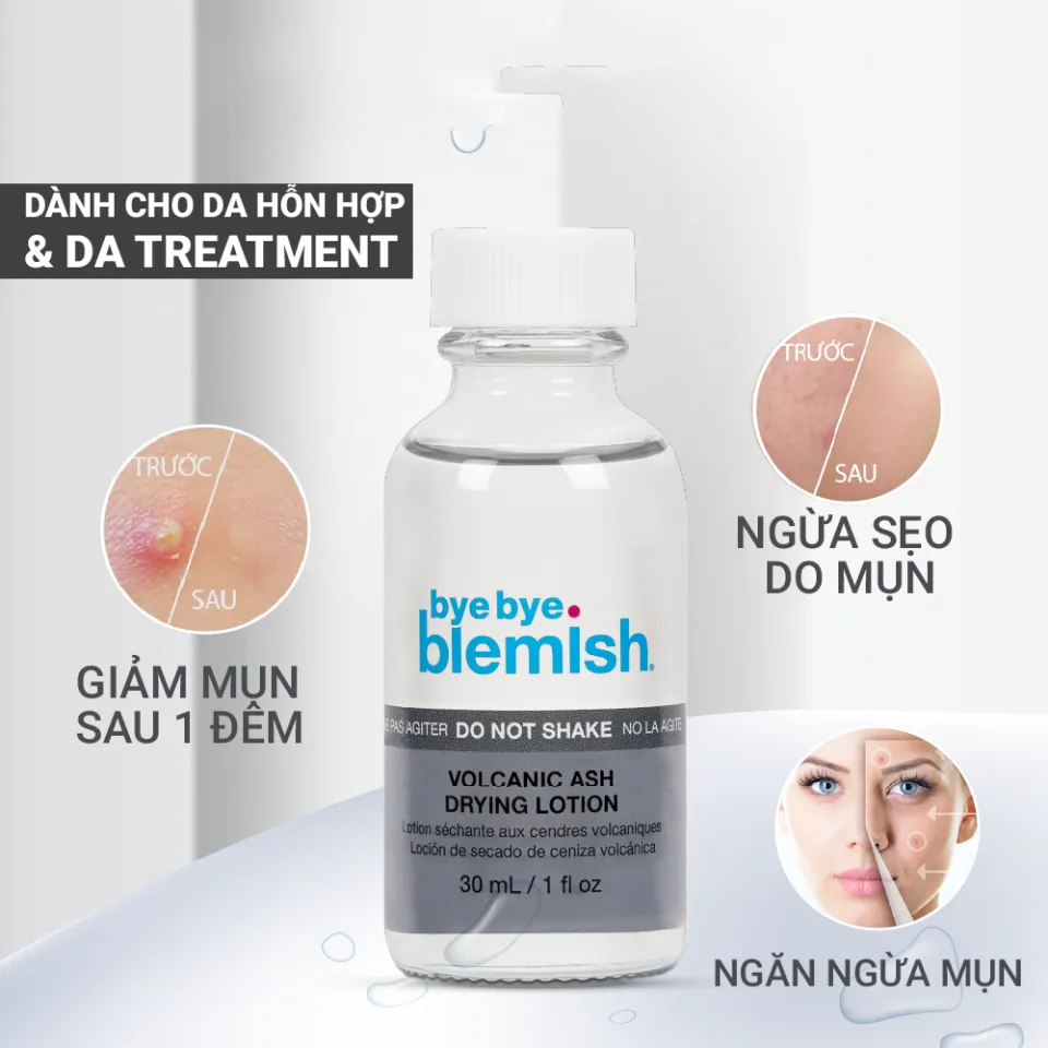 Bye bye Blemish Chấm mụn Volcanic Ash Drying Lotion 30mlBye bye Blemish ...