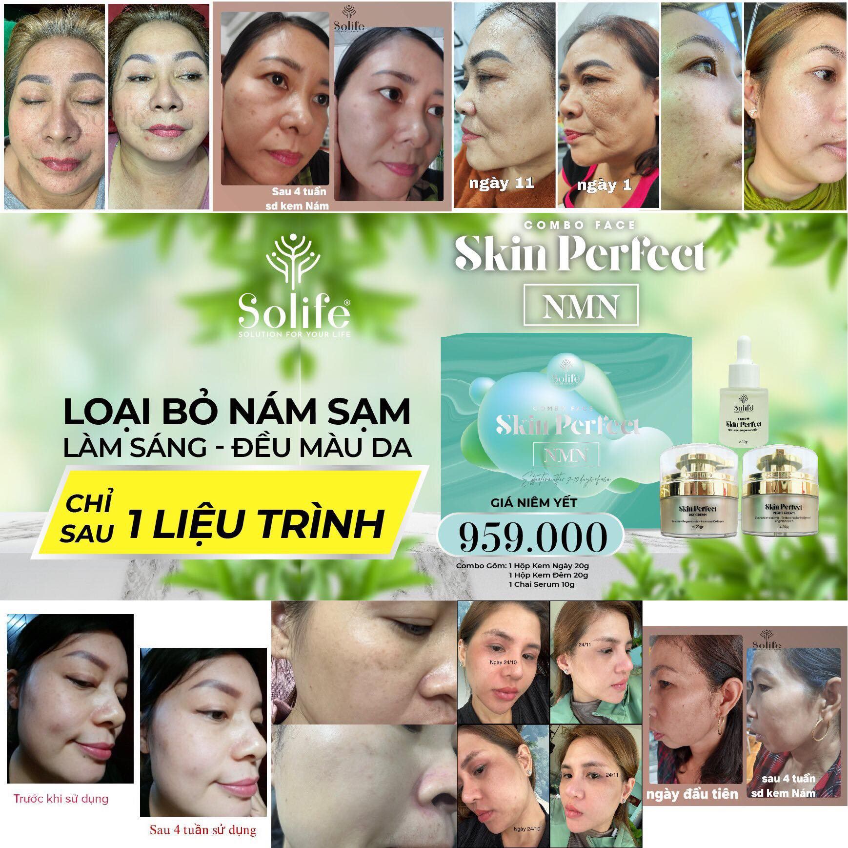 COMBO SKIN PERFEET NMN - BỘ TRỊ NÁM NMN – Solifevietnam