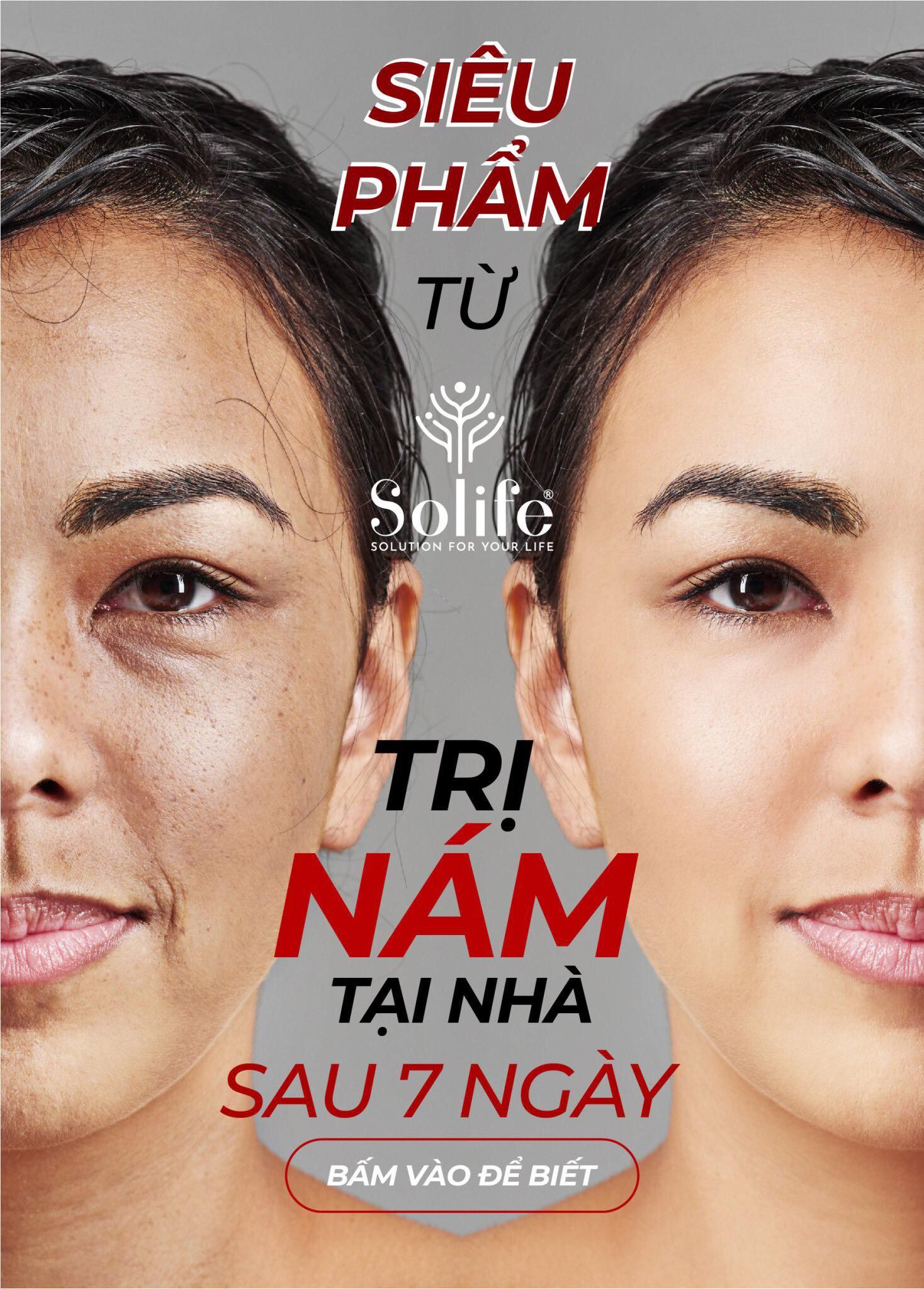 COMBO SKIN PERFEET NMN - BỘ TRỊ NÁM NMN – Solifevietnam