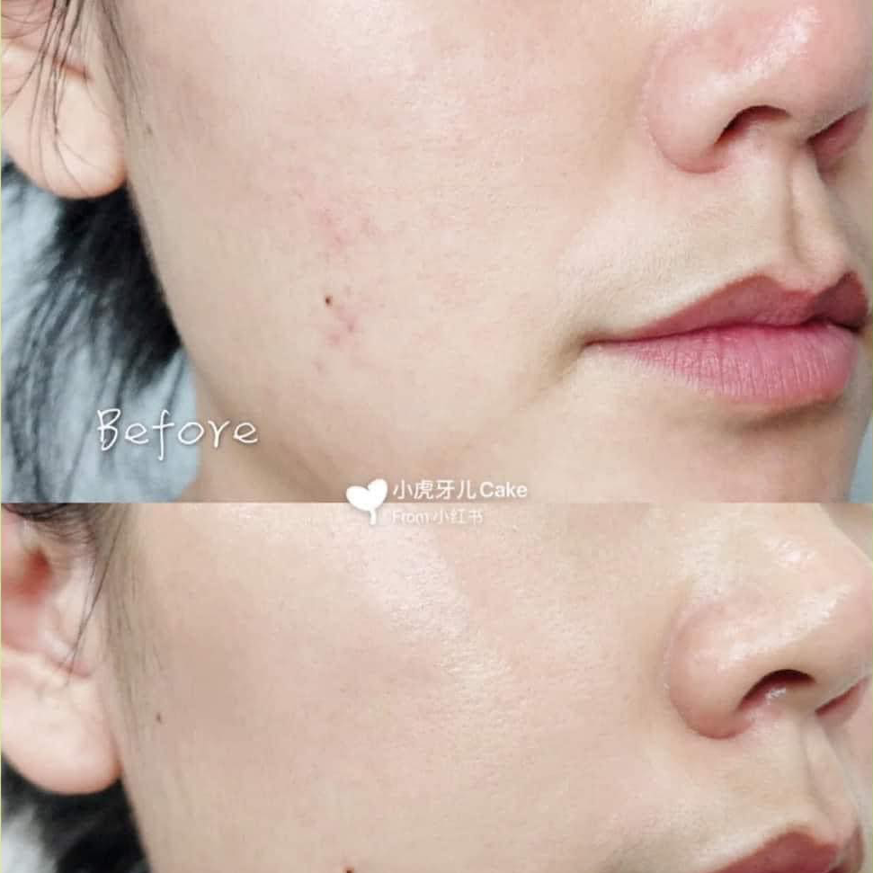 Serum Drunk Elephant B-Hydra Intensive Hydration Pro-Vitamin B5 Cấp ...