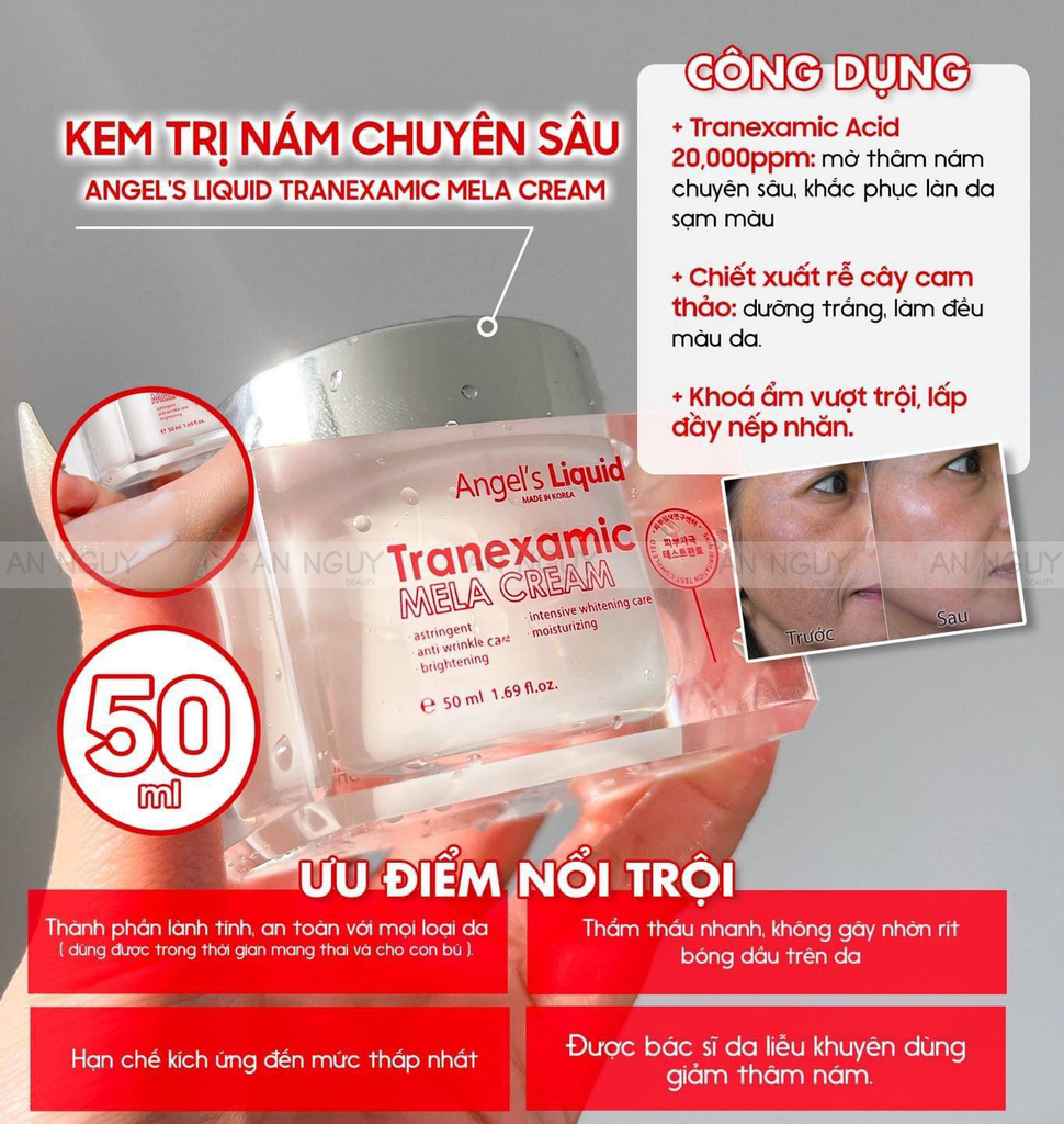 Kem Dưỡng Angel's Liquid Tranexamic Mela Cream Mờ Thâm Nám Chuyên Sâu ...