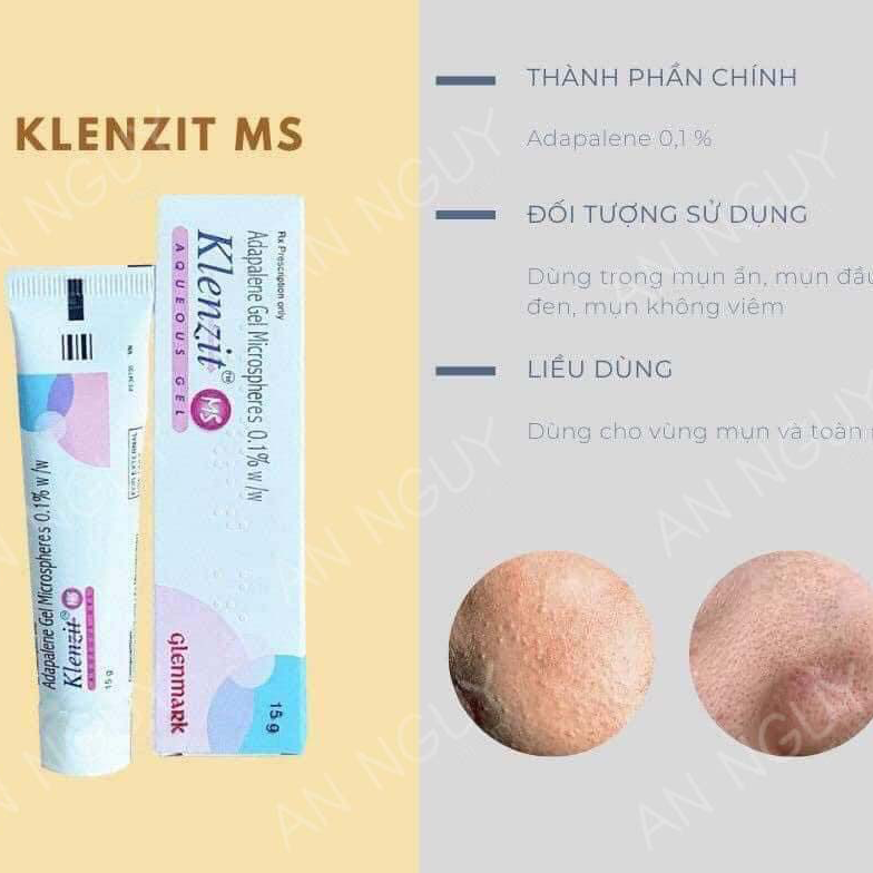 Gel Trị Mụn Glenmark Klenzit MS Aqueous Gel Dành Cho Da Bị Mụn Ẩn, Mụn ...