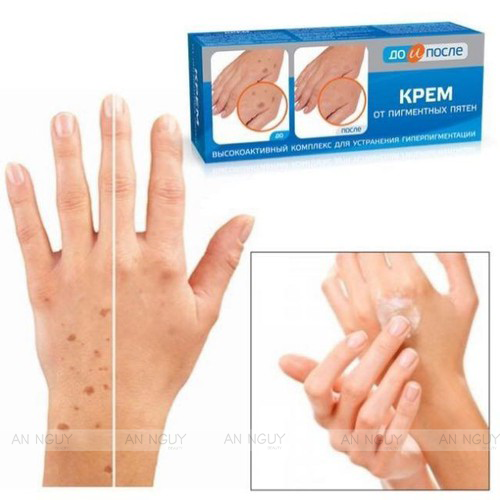 Kem Dưỡng Mờ Nám Tay Kpem Twins Tec Dưỡng Da Tay Mịn Màng 50mlKem Dưỡng ...