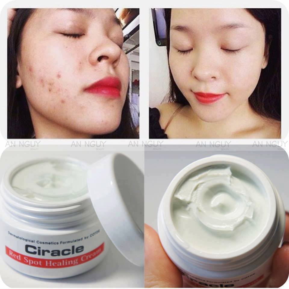 Kem Dưỡng Ciracle Red Spot Cream Làm Giảm Mụn Sưng Đỏ, Mụn Mủ 30grKem ...
