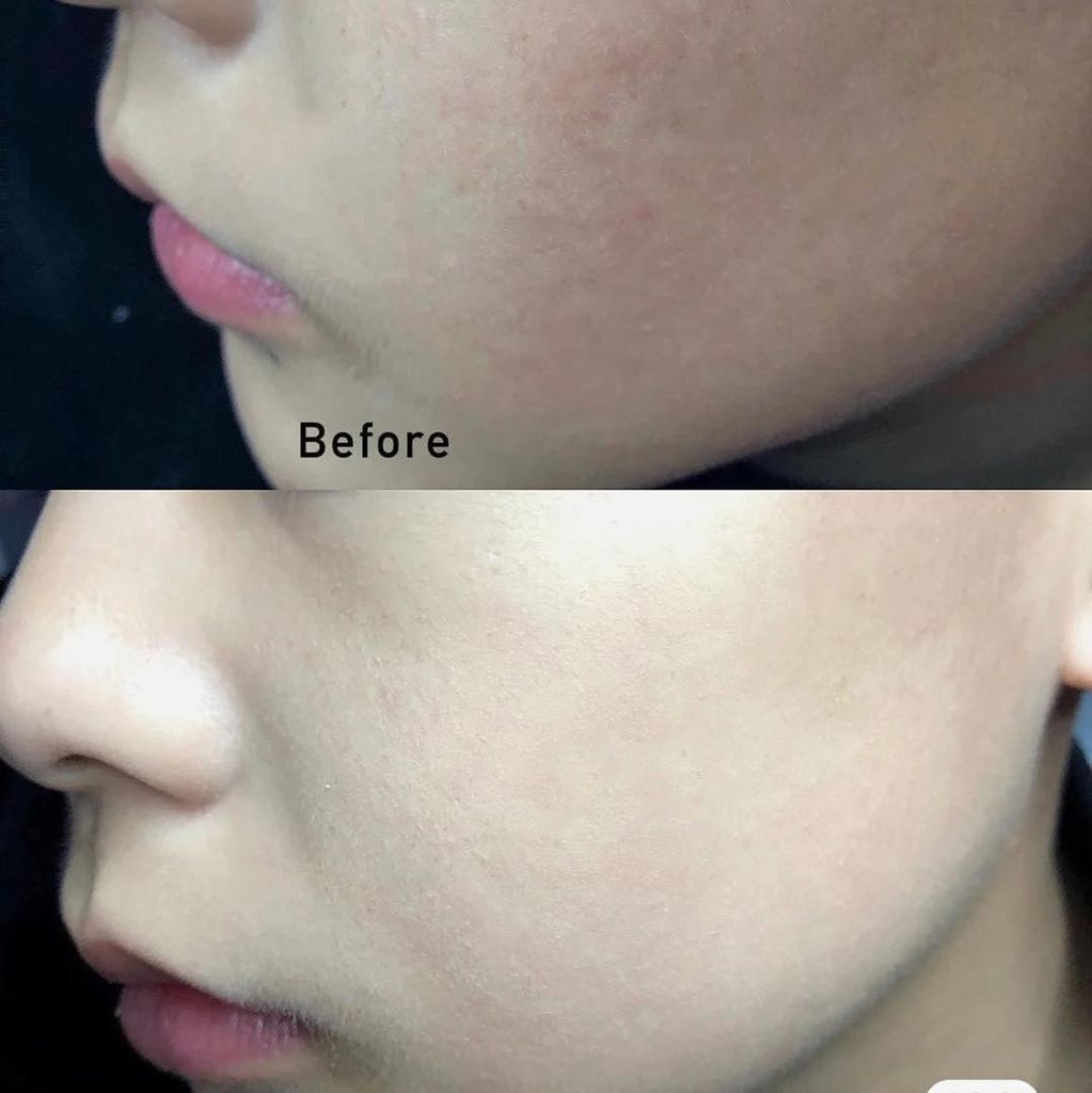 Nước Uống Trắng Da Shiseido Pure WhiteNước uống trắng da Pure White ...