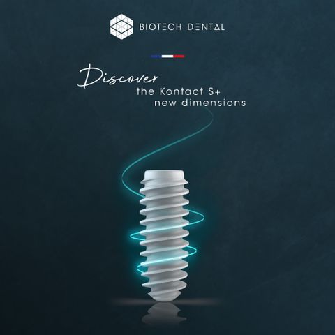 Implant – Biotech Dental Vietnam