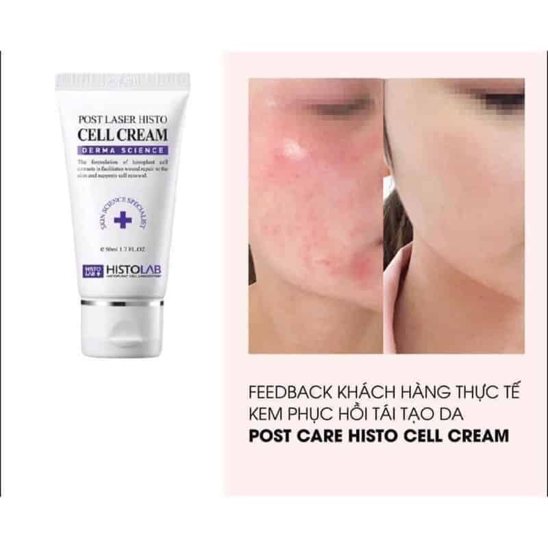 Kem Dưỡng Ẩm Phục Hồi Da Sau Laser Post Care Histolab Cell Cream 50mlKem Dưỡng Ẩm Phục Hồi Da ...