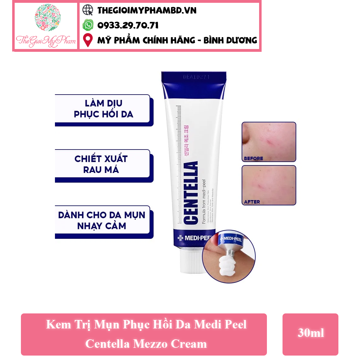 Kem Trị Mụn Phục Hồi Da Medi Peel Centella Mezzo Cream 30mlKem Trị Mụn ...