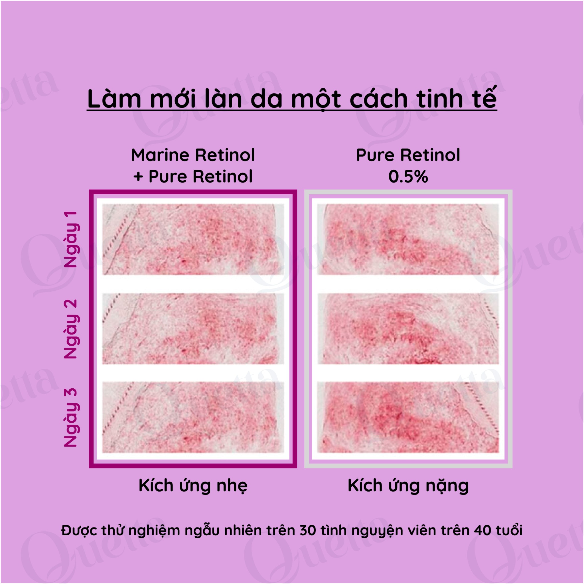 Serum Retinol Tái Tạo Da Sau Mụn Và Chống Lão Hóa Segle Pure Retinol ...