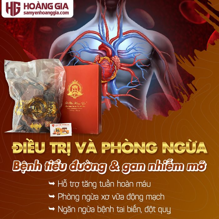Nấm lim xanh rừng Lê Phúc Hoàng Gia Golden Class hộp 400gr - Sâm Yến ...