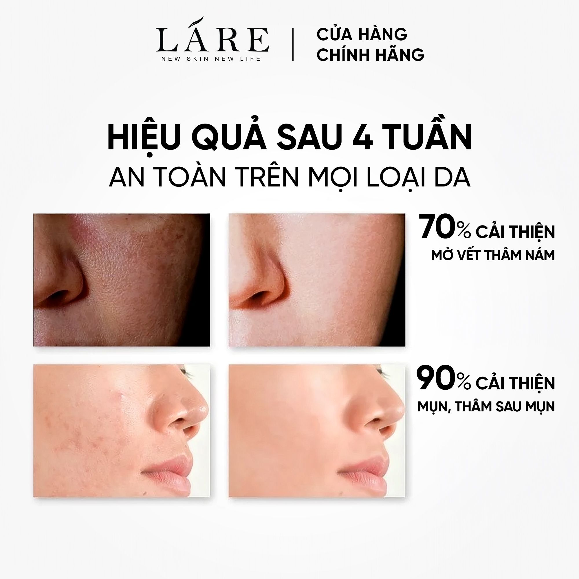Serum herbal Ver 2 – Láre Việt Nam