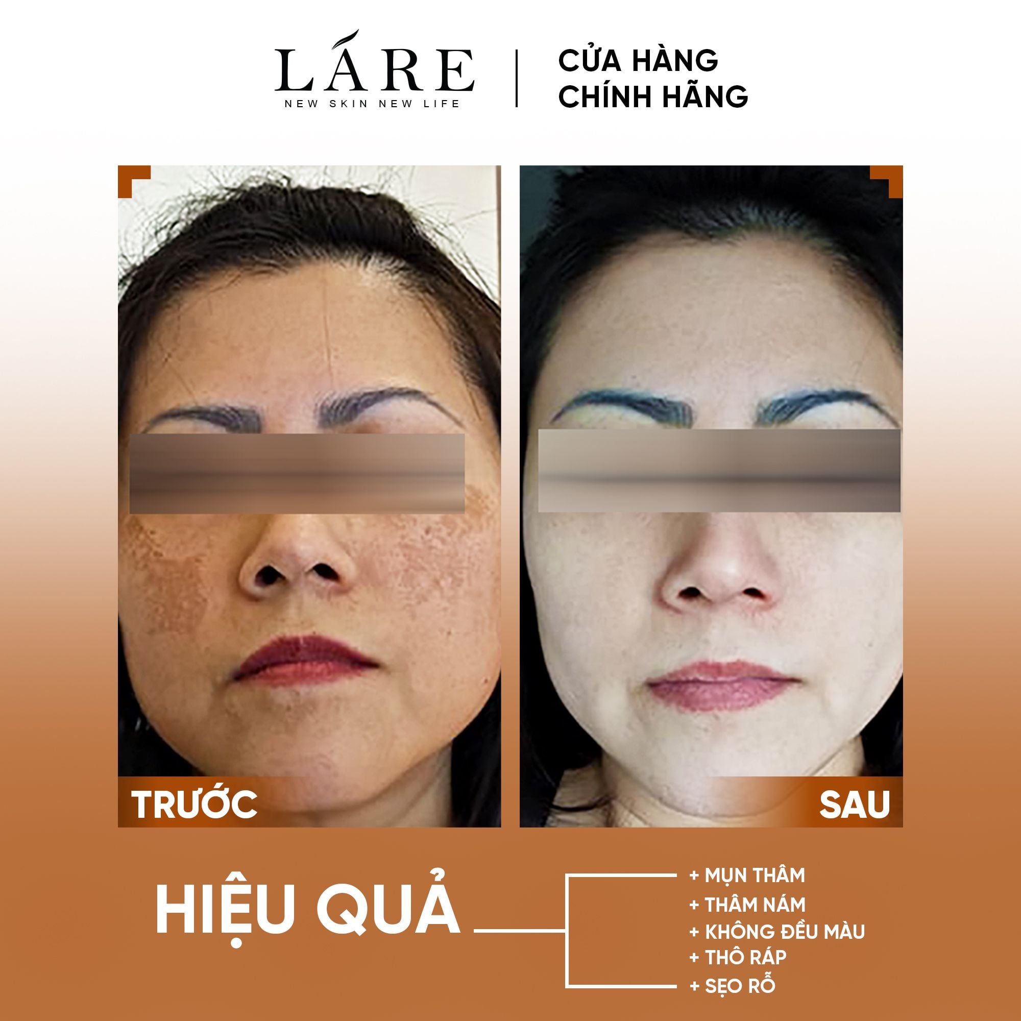 Serum Láre Herbal – Láre Việt Nam
