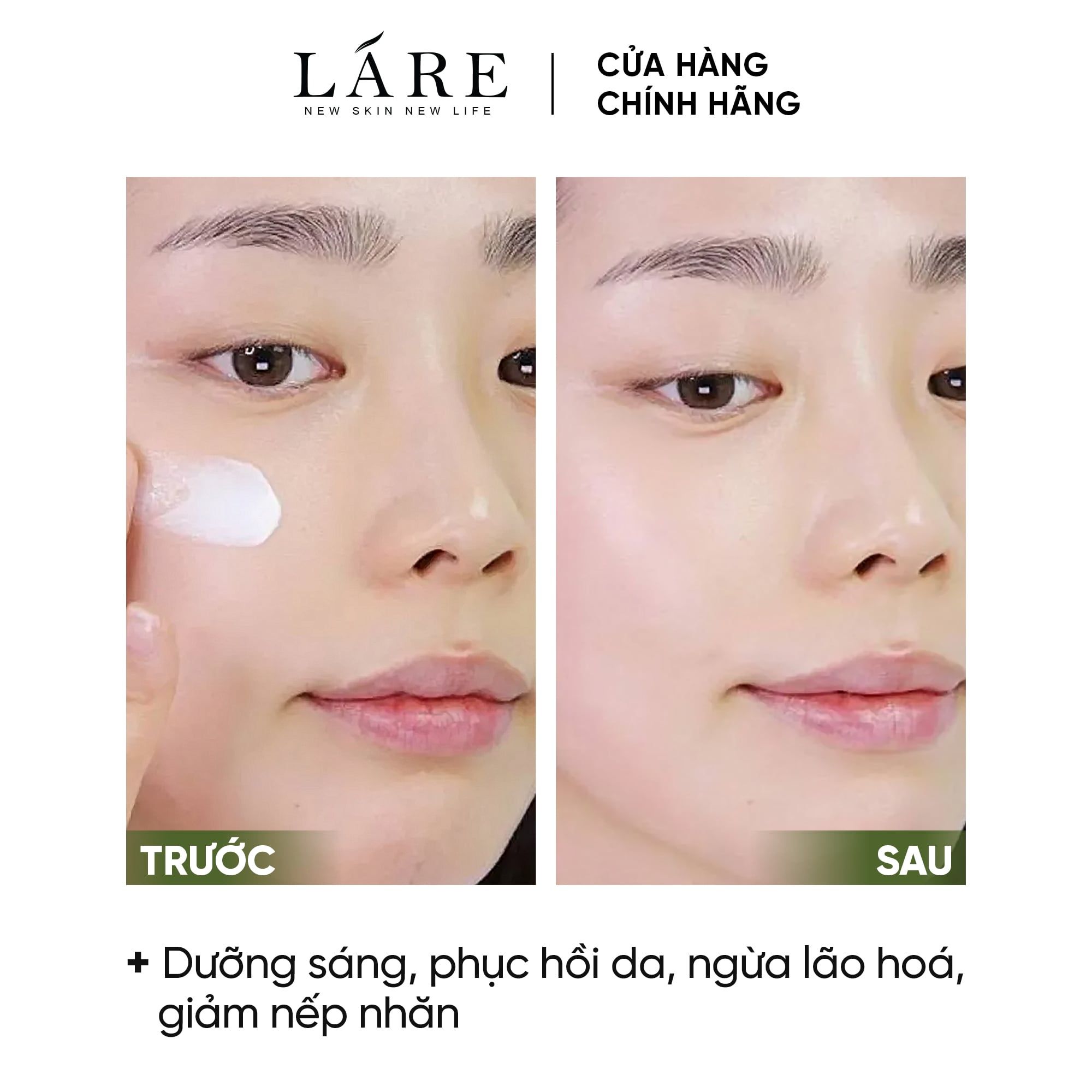 Kem chống nắng – Láre Việt Nam