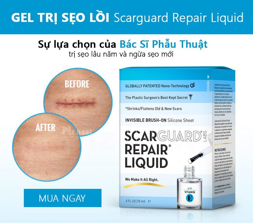 Gel Trị Sẹo Lồi Scarguard Repair Liquid 15ml (Scarguard MD) – NzHeal ...